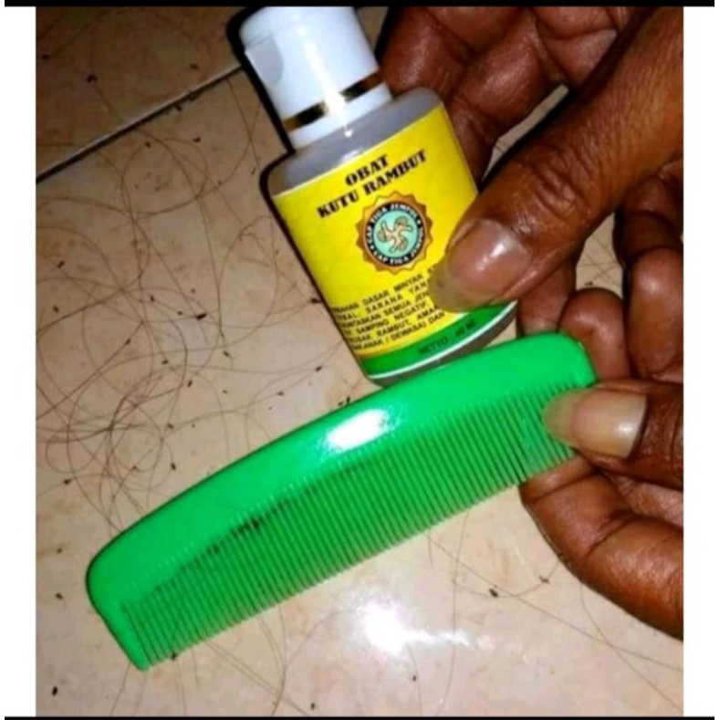 Jual minyak pembasmi kutu rambut 30 ml( ecer/grosir). | Shopee Indonesia