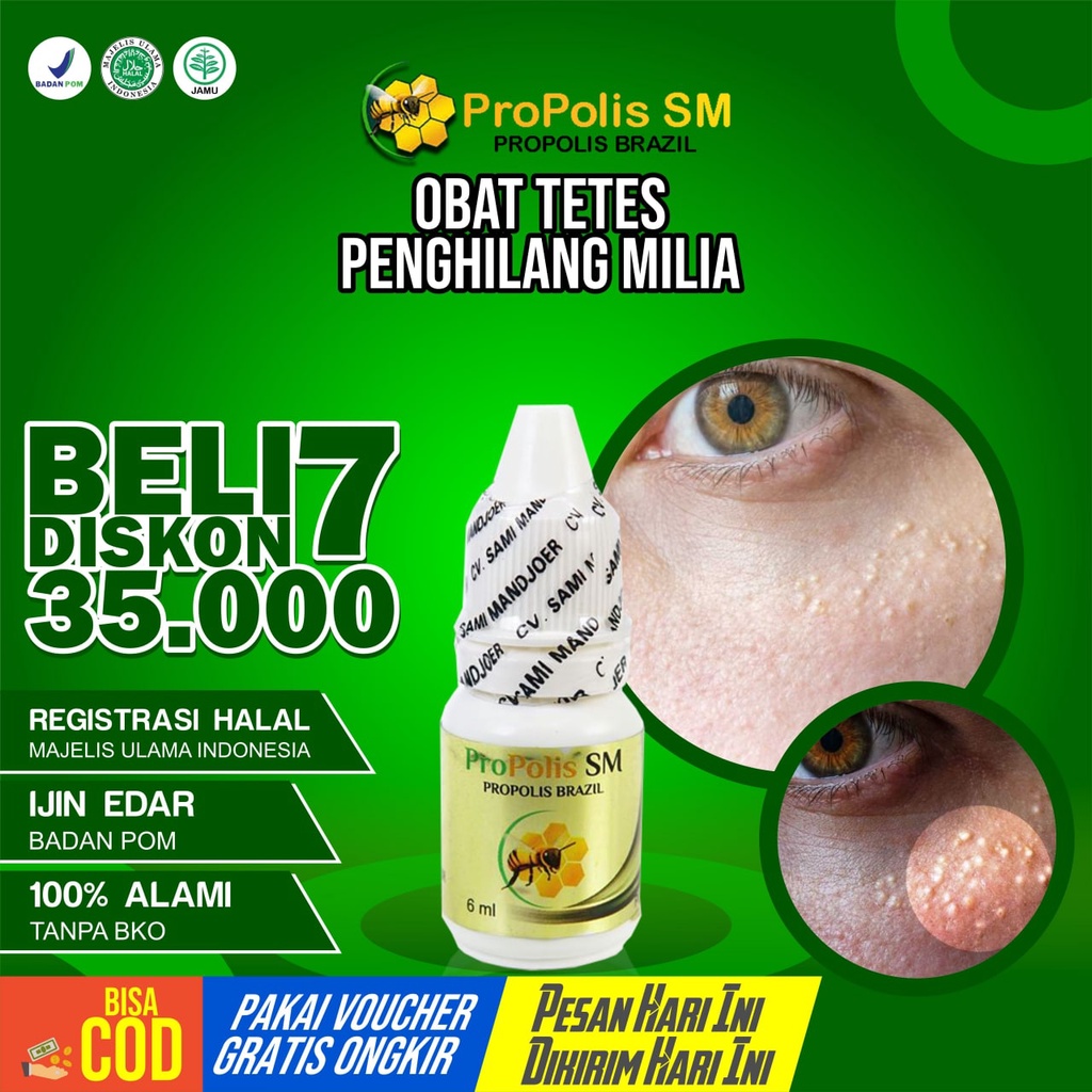 Jual Obat Milia - Obat Tetes Penghilang Milia DIwajah Bawah Mata ...