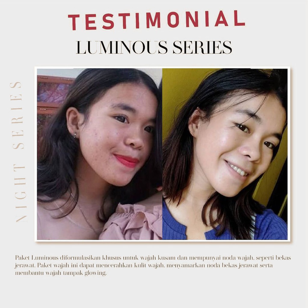 Jual MS GLOW PAKET WAJAH FREE PRODUK DAN POUCH | Shopee Indonesia