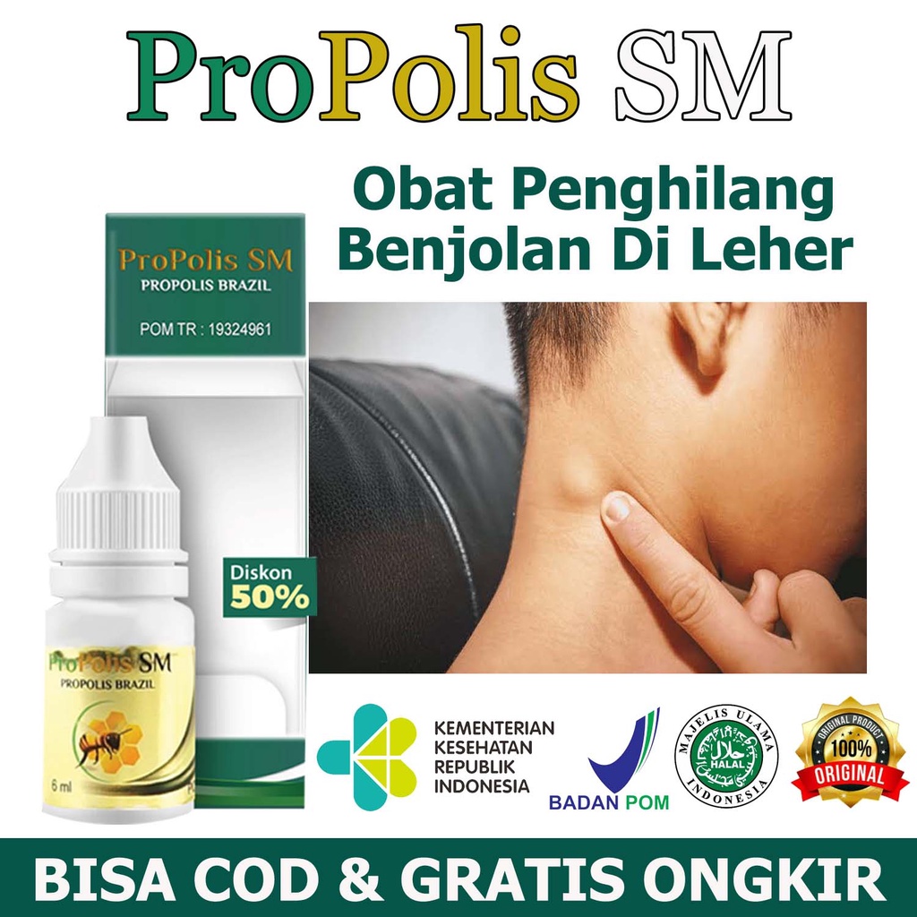 Jual Propolis SM Brazil Original Obat Benjolan Di Leher Tangan Perut ...