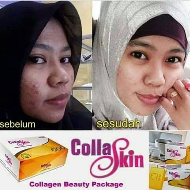 Jual Collaskin Collagen | Shopee Indonesia