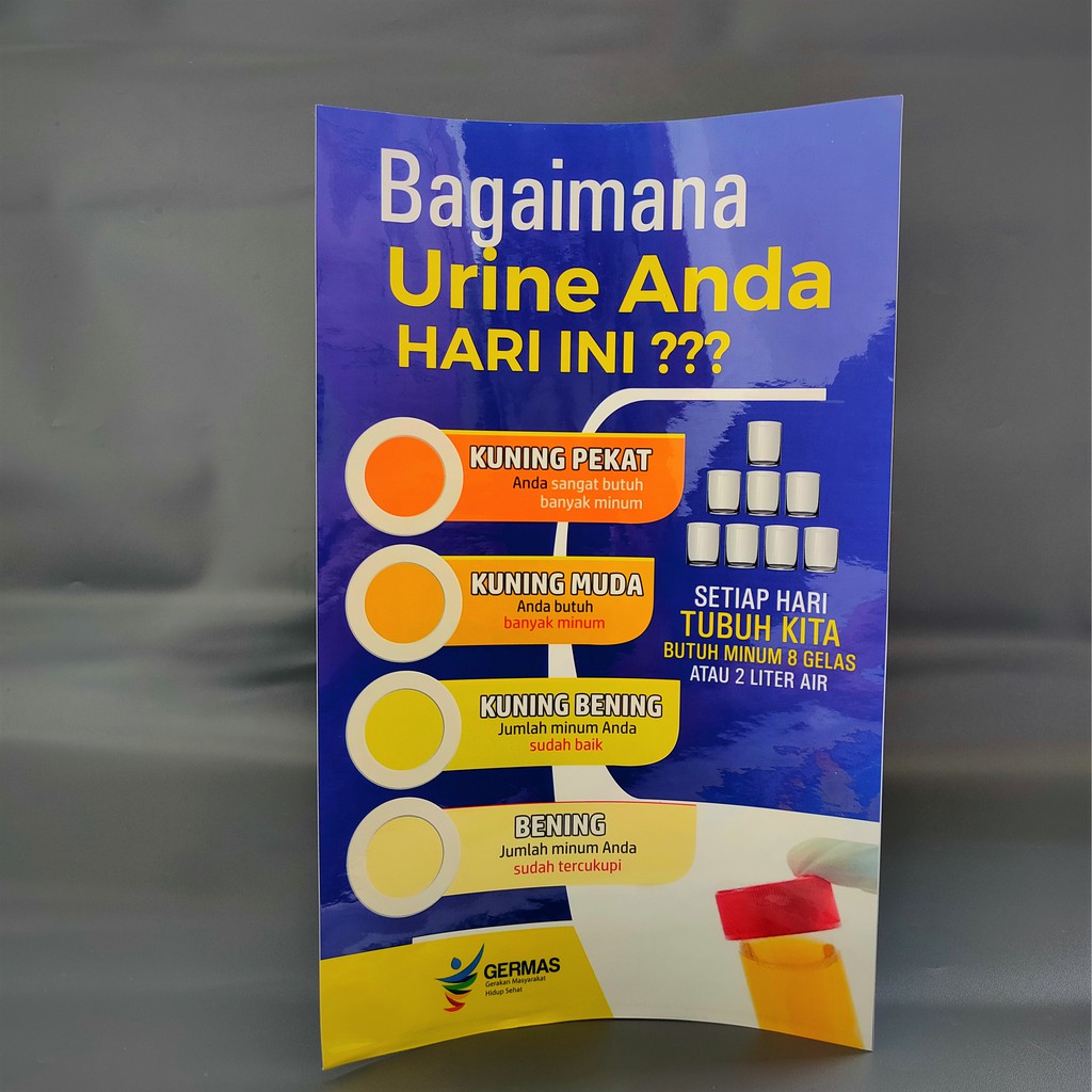 Jual Stiker Indikator Urine | Stiker Vinyl Indikator Warna Urine ...