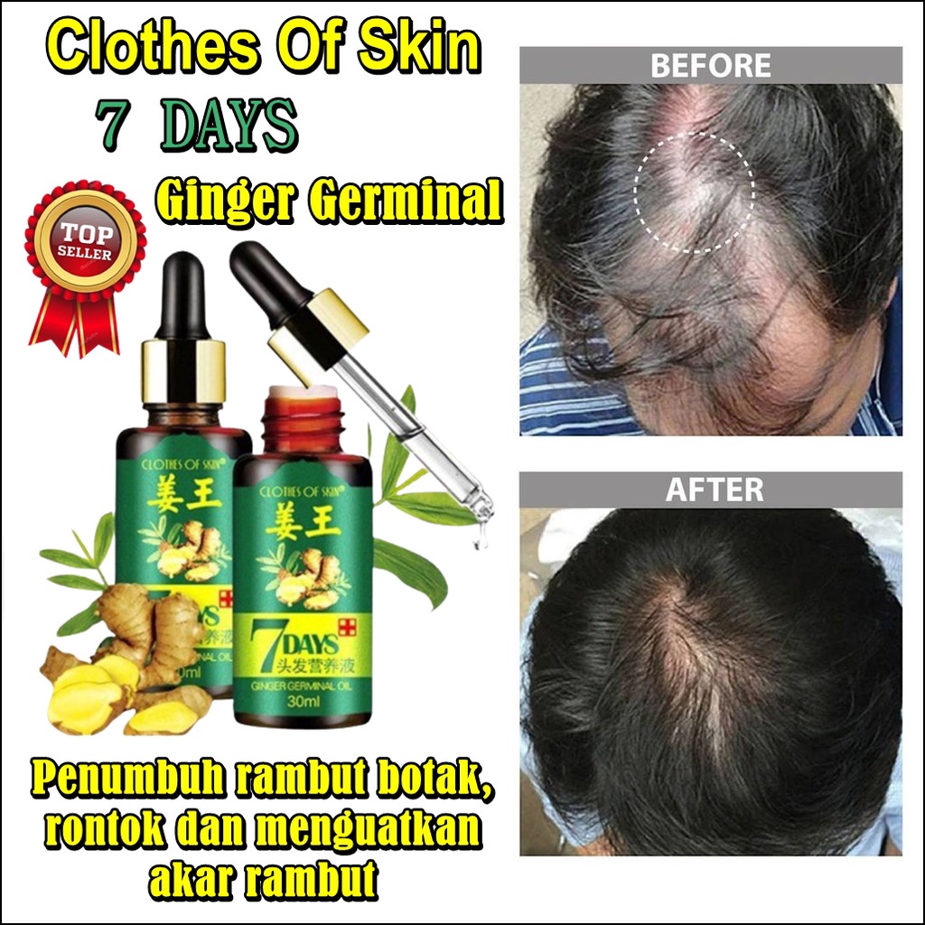 Jual Serum LUCKY77 - Rambut Anti Botak Clothes of Skin Ginger Germinal ...