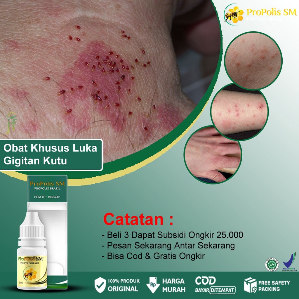 Jual Obat Luka Bekas Gigitan Kutu Alergi Scabies Bintik Merah Kaligata ...