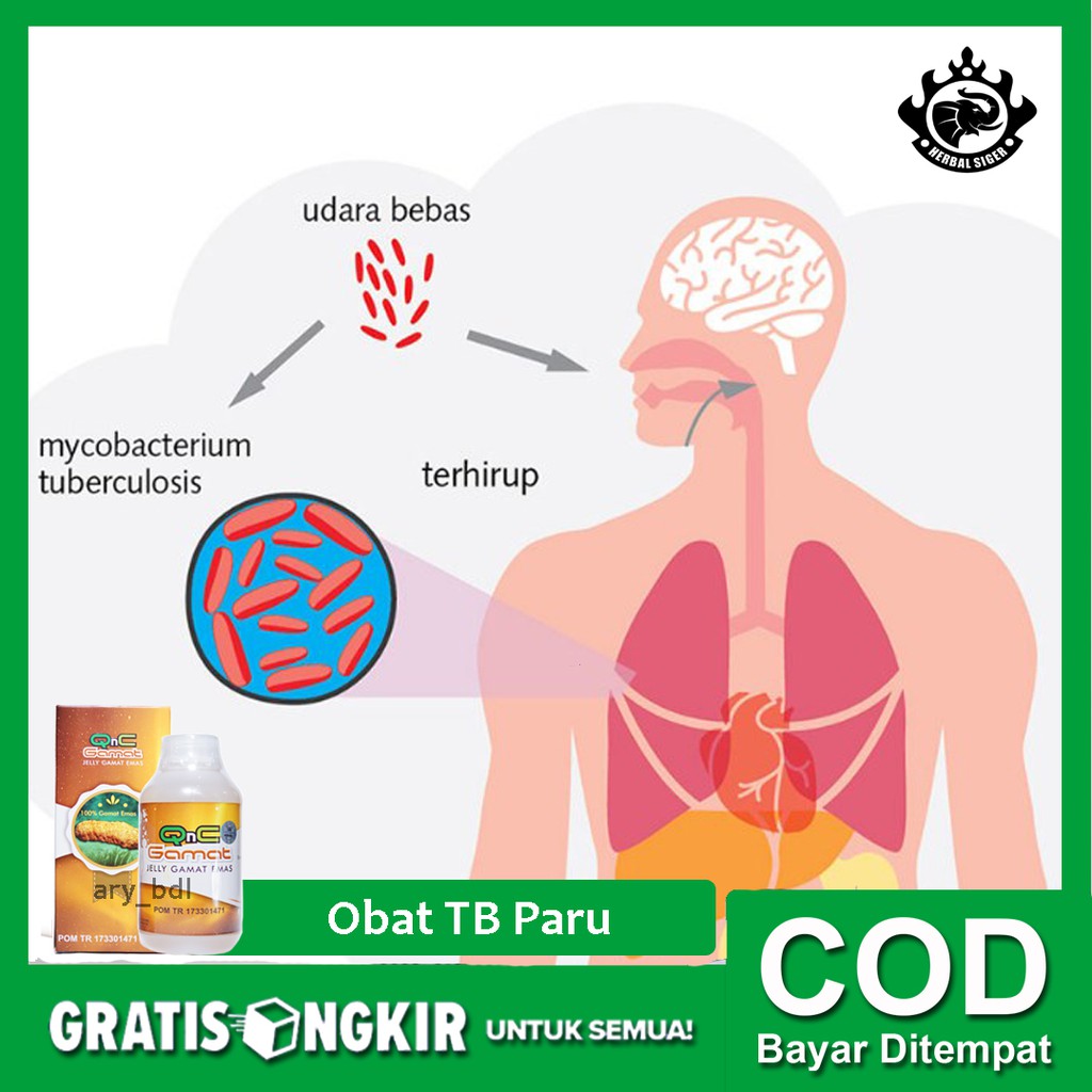 Jual Obat Herbal TB Paru - Tuberkulosis - Batuk Berkepanjangan Termurah ...