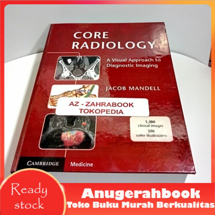 Jual PROMO buku Core Radiology: A Visual Approach to Diagnostic Imaging ...