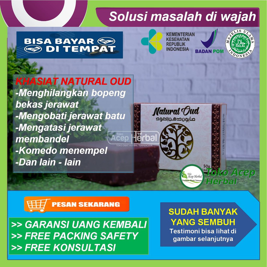 Jual Obat Bopeng - Obat Jerawat Membandel - Obat Komedo Menempel - Obat ...