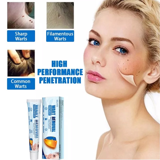 Jual Skin Tag Remover Menghilangkan Kutil Tahi Lalat Mata Ikan Wart ...