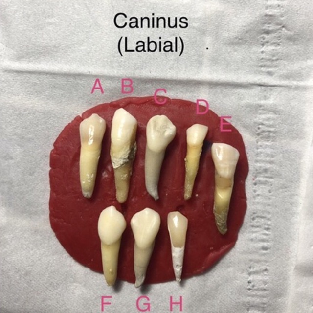 Jual JUAL GIGI CANINUS RA RB ( GIGI ASLI PRAKTIKUM) | Shopee Indonesia