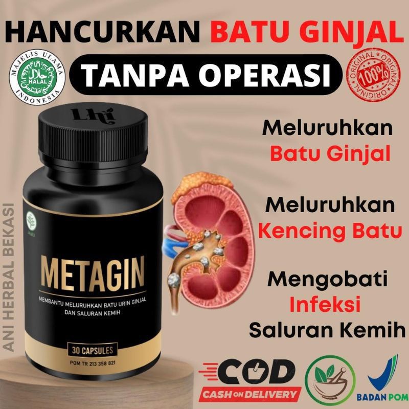 Jual Metagin Asli Obat Batu Ginjal & Empedu - Ayang Ayangan Pria ( toko ...