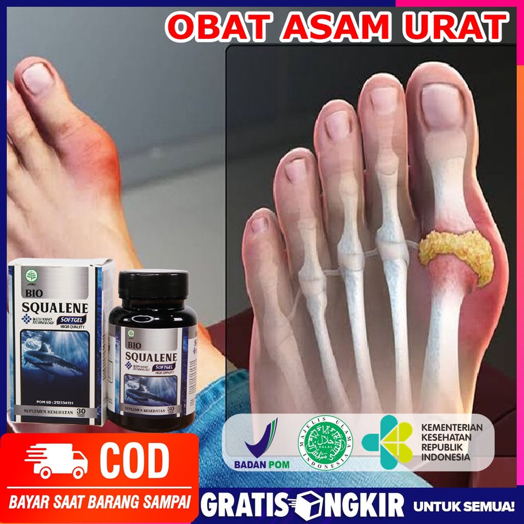 Jual obat asam urat asli herbal untuk nyeri sendi kaki lutut kaku ...