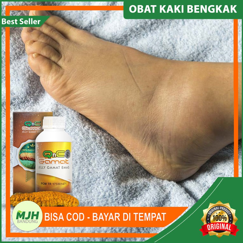 Jual Obat Kaki Bengkak - Kaki Kapalan - Kaki Gajah | Shopee Indonesia