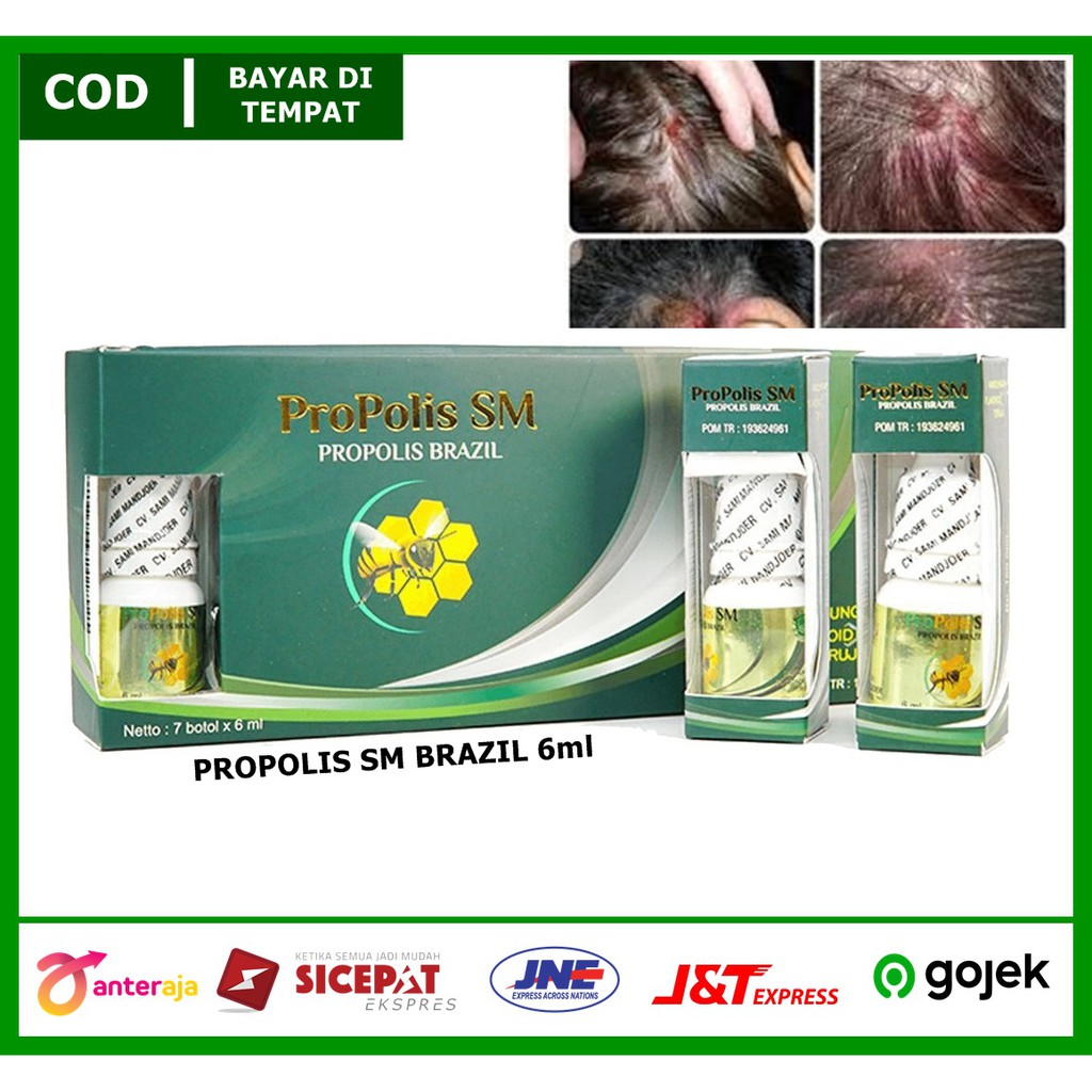 Jual Obat Gatal Ketombe Basah, Kering, Di Kepala, Borok, Psoriasis, Koreng, Jamur, Borok ...