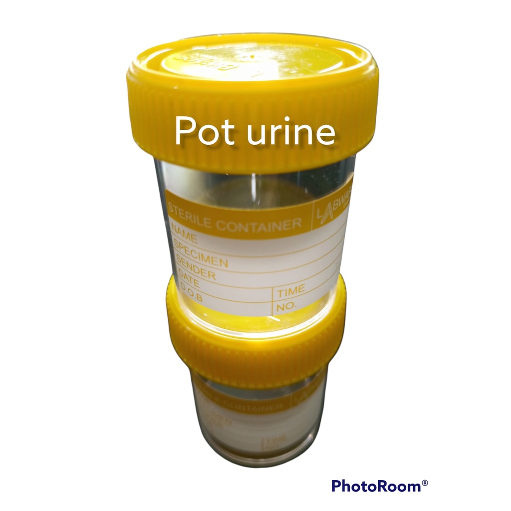 Jual POT URINE POT URIN SAMPLE CONTAINER STERIL 50ML | Shopee Indonesia