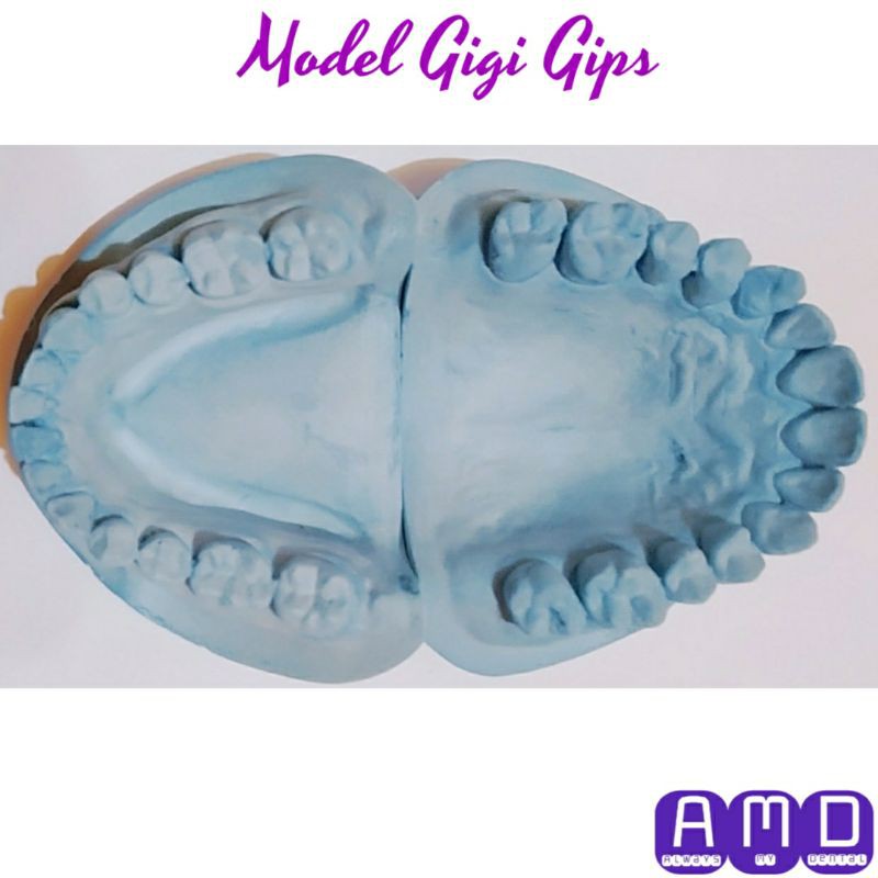 Jual Model Gigi Gips Biru (Rahang Atas dan Rahang Bawah) | Shopee Indonesia