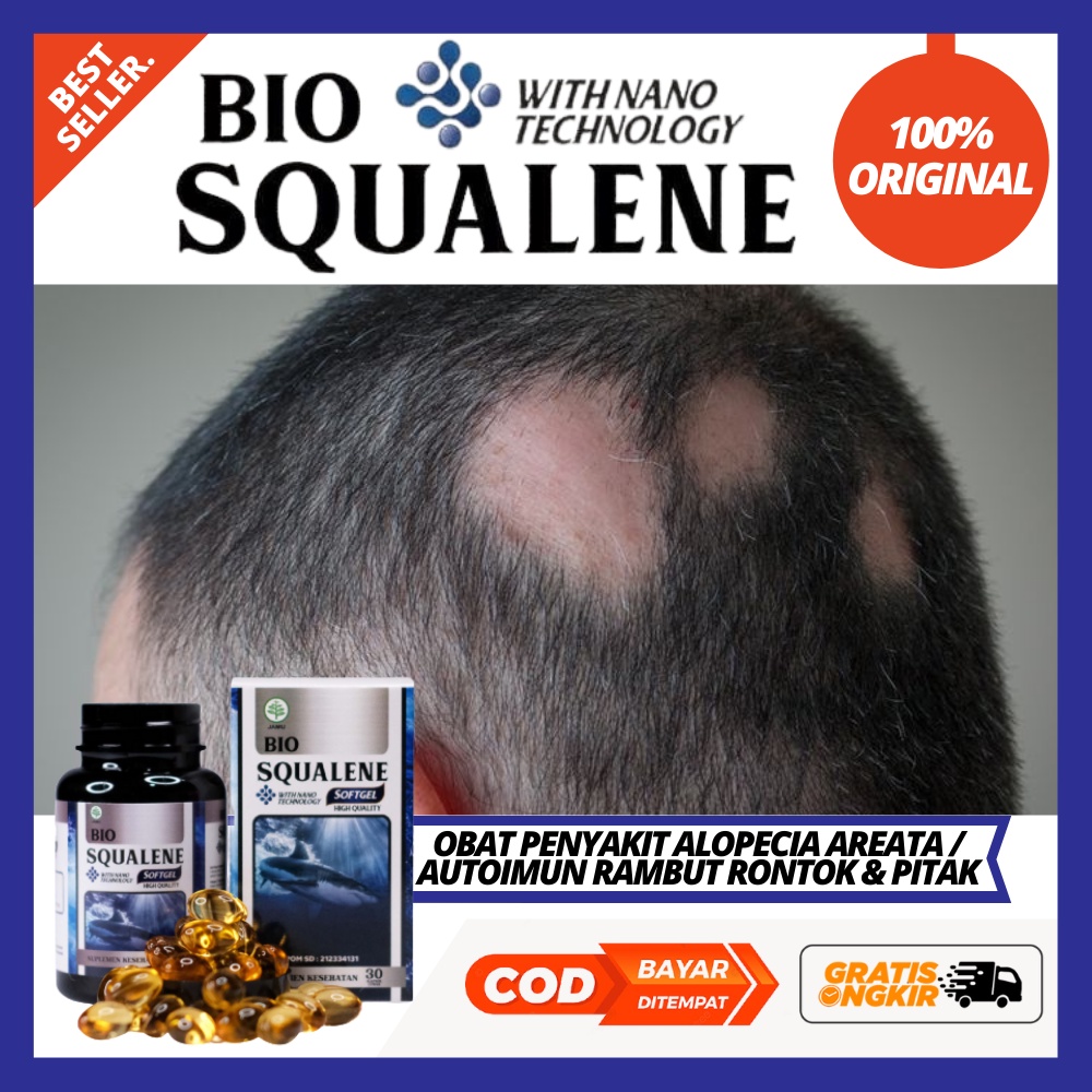 Jual Obat Auto Imun / Alopecia Areata / Rambut Botak, Rontok, Pitak ...