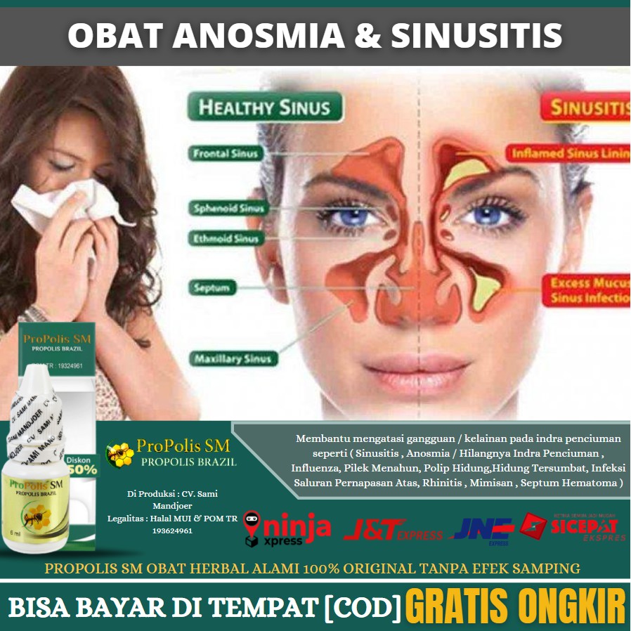 Jual Obat Radang Sinus Akut, Radang Hidung, Tidak Bisa Mencium,Hidung ...