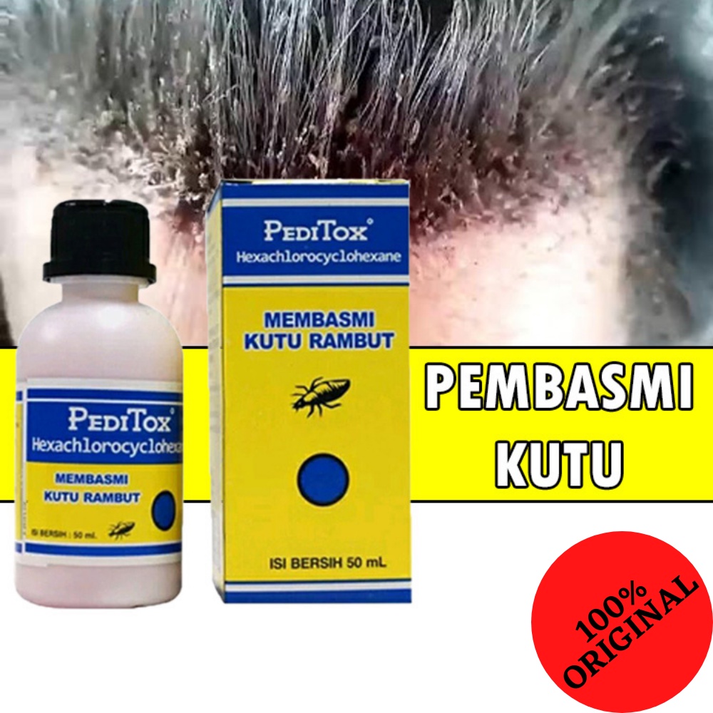 Jual Obat Kutu Rambut Paling AMPUH PediTox / Pedi Tox 100% Original ...