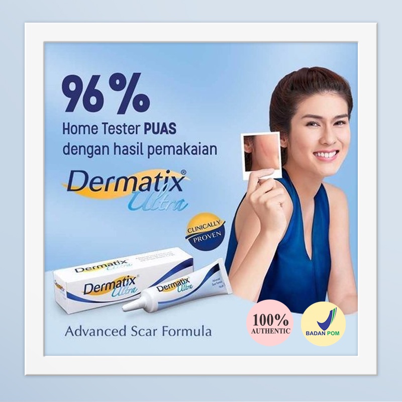Jual Dermatix Ultra Gel / Krim Penghilang Bekas Luka / Obat Keloid ...