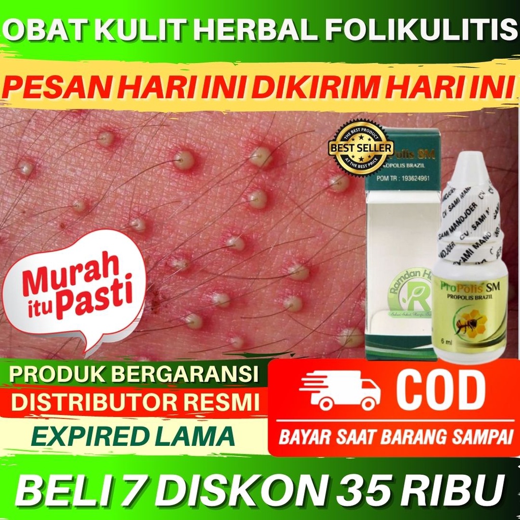 Jual Obat Penyakit Kulit Folikulitis, Peradangan, Infeksi Bakteri ...