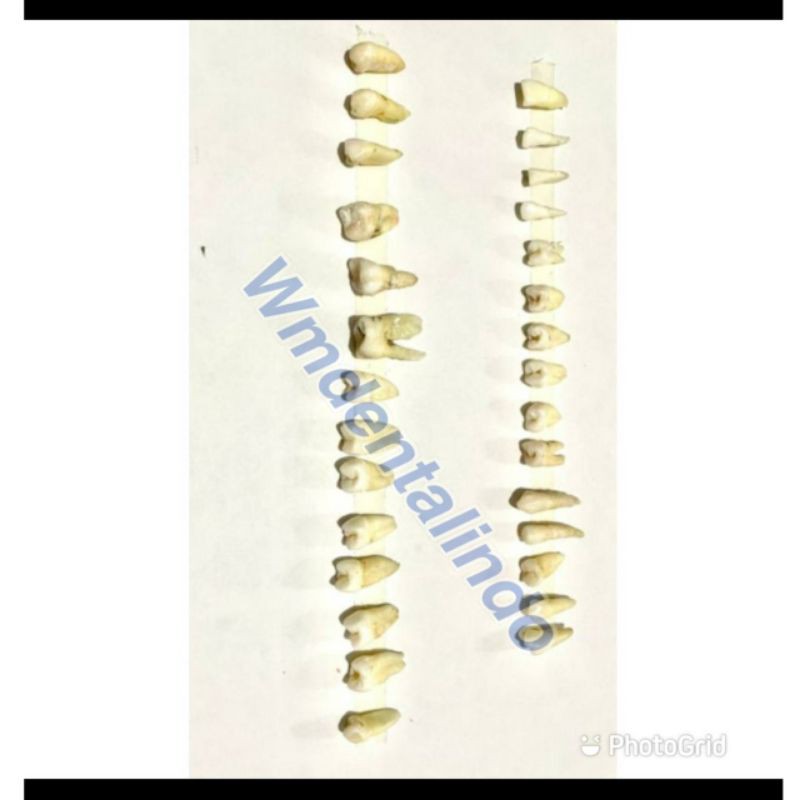 Jual gigi praktikum kedokteran gigi satuan insisivus caninus premolar ...