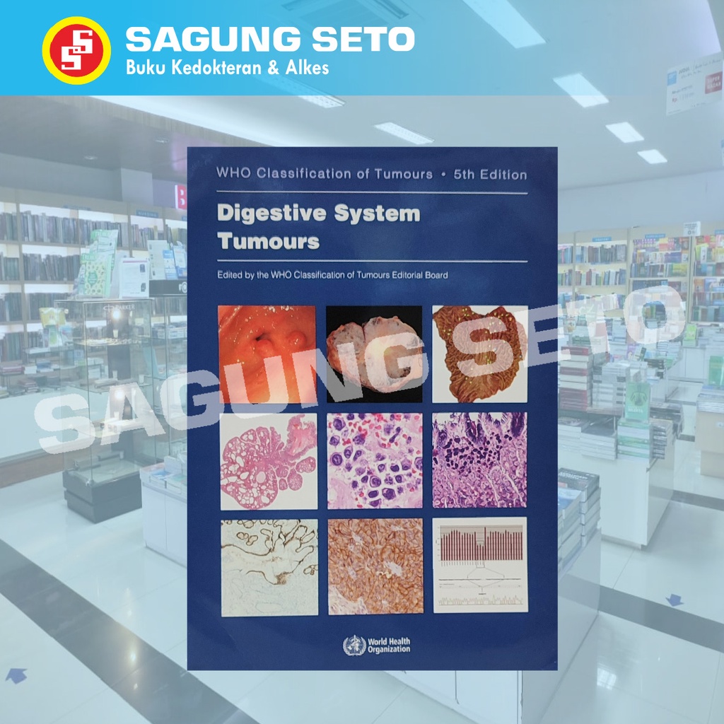 Jual WHO CLASSIFICATION OF TUMOURS- DIGESTIVE SYSTEM TUMORS 5ED ...