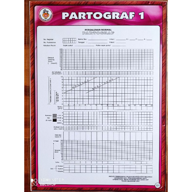 Jual (221) POSTER PARTOGRAF LEMBAR 1 | Shopee Indonesia