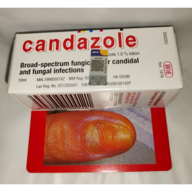 Jual Candazole 10ml (Clotrimazole 1% Lotion) | Shopee Indonesia