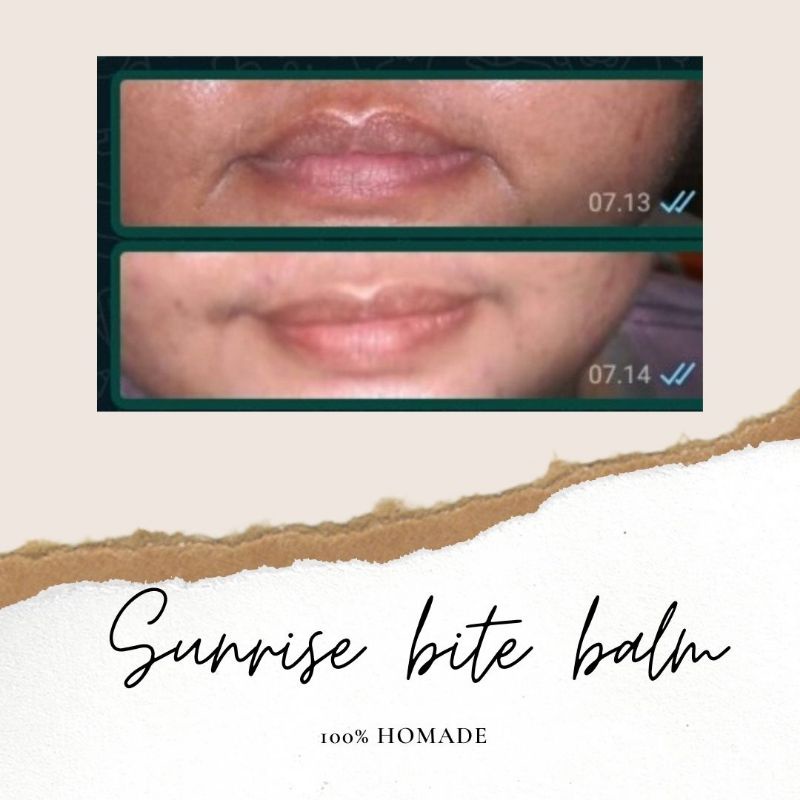 Jual lip balm minyak buah merah papua DAILY USE - souvenir | Shopee ...