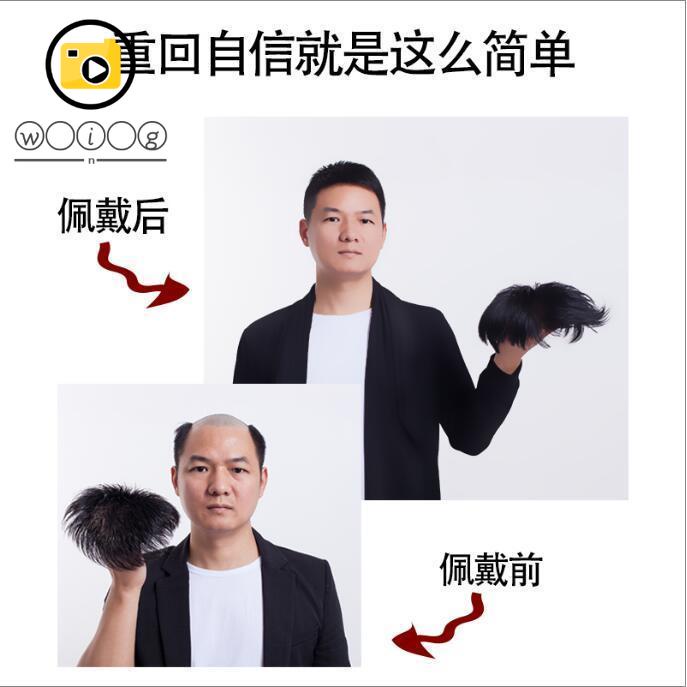 Jual Wig Pria Rambut Pendek Pria Tampan Dahi Kepala Botak Pengganti ...