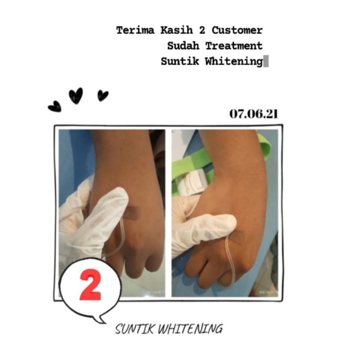 Jual jasa infus whitening vit c dan booster cromosome dg tenaga medis ...