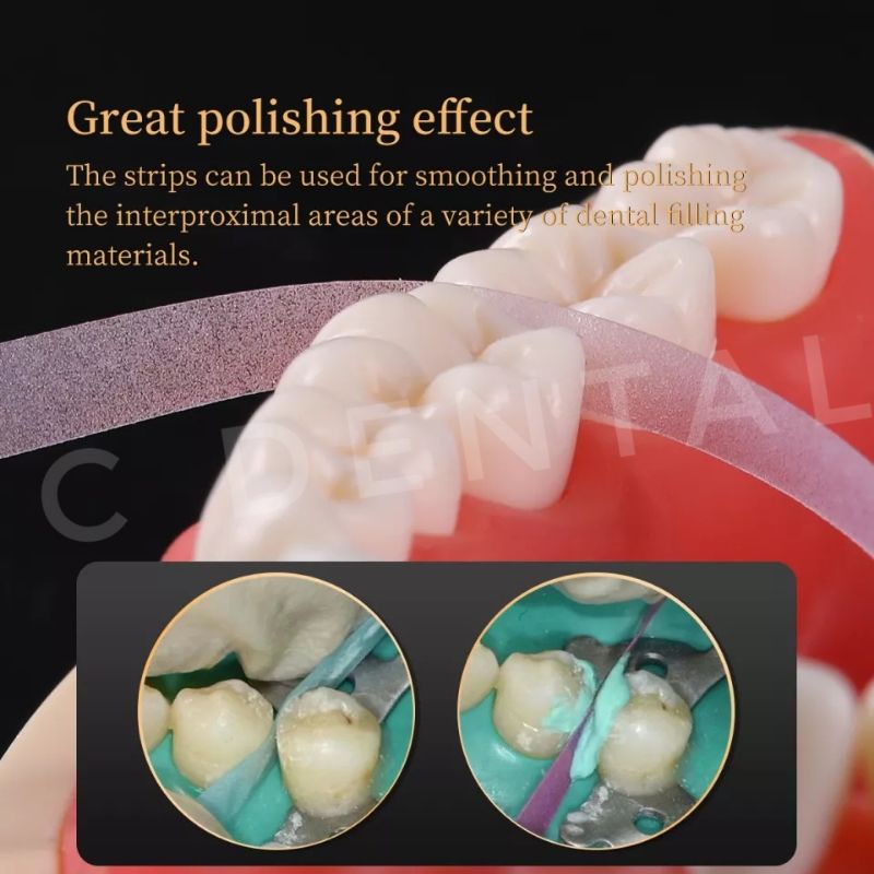 Jual Dental Composite Polishing Strip Poles Tambalan Komposit Gigi ...