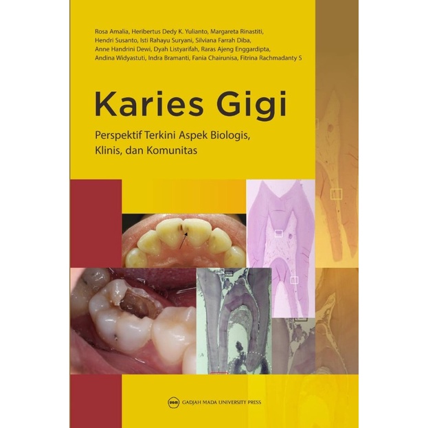Jual UGM Press Buku Original KARIES GIGI: Perspektif Terkini Aspek ...