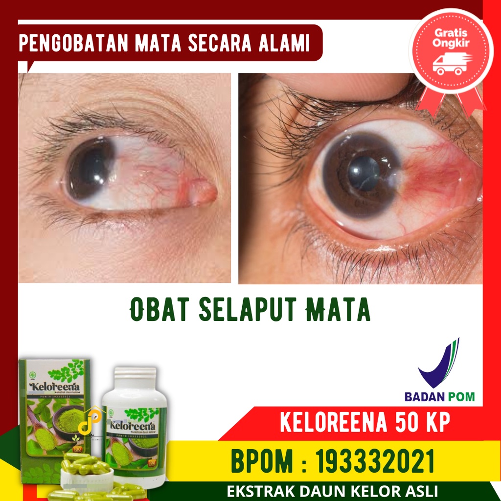 Jual Obat Syaraf Mata Rusak, Mata Glukoma, Mata Merah, Rabun Jauh Obat ...