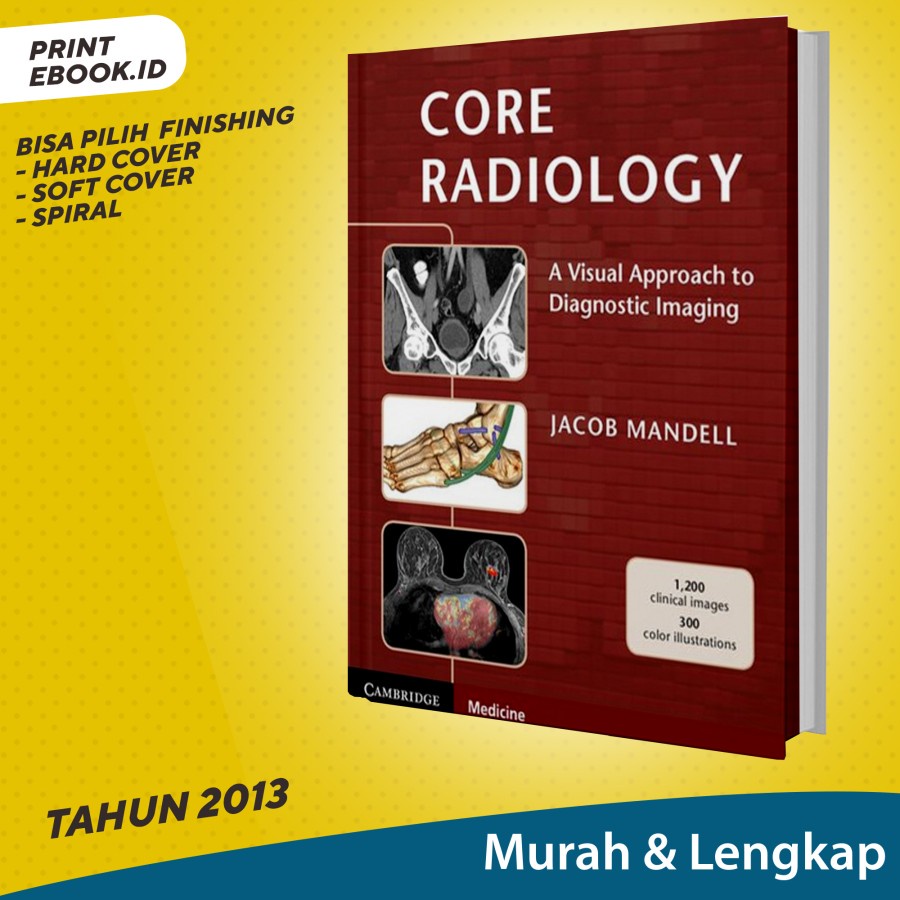 Jual Core Radiology: A Visual Approach to Diagnostic Imaging | Shopee ...