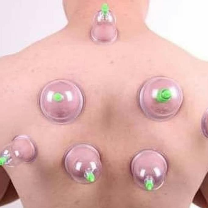 Jual KOP ANGIN ALAT BEKAP ISI 6 TABUNG | Shopee Indonesia