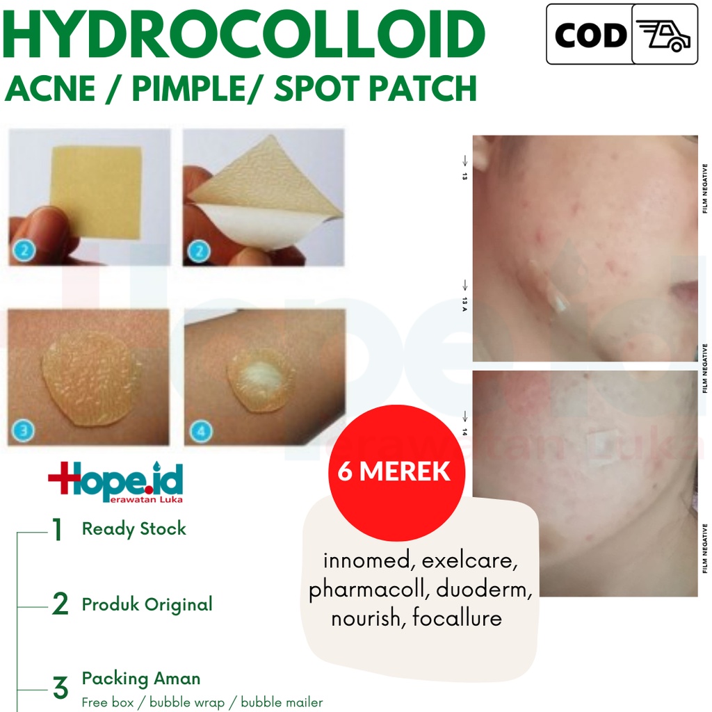 Jual Hydrocolloid Extra Thin Acne Pimple Patch 10 cm x 10 cm Pharmacoll ...