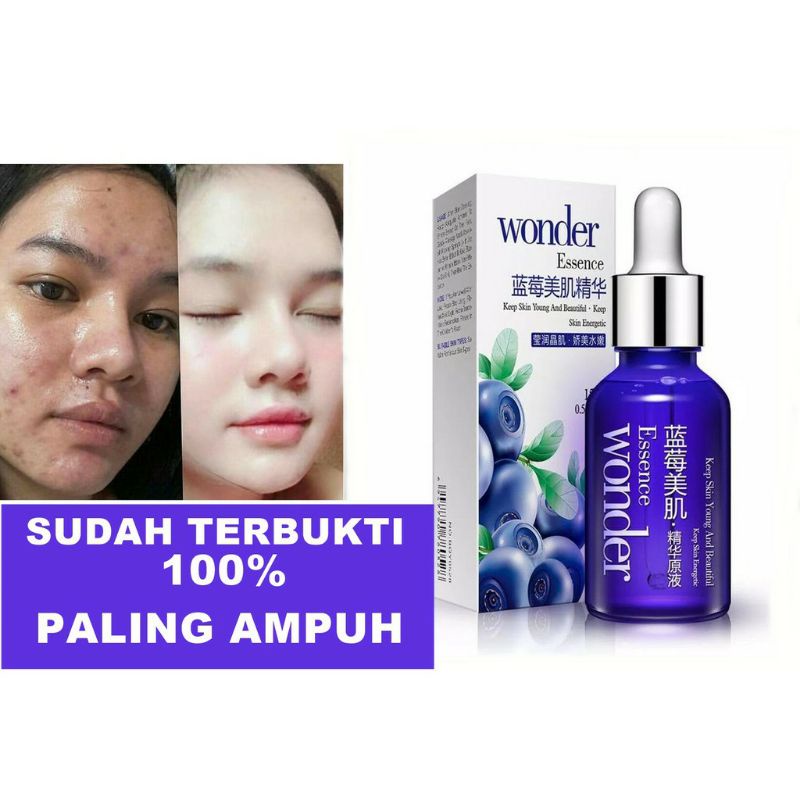 Jual SERUM WONDER SERUM WAJAH PERAWAT WAJAH MEMPERBAIKI WAJAH YANG ...