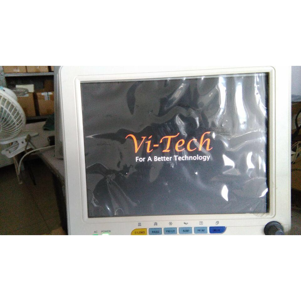 Jual Patient Monitor 12" include recorder (internal printer) | Shopee ...