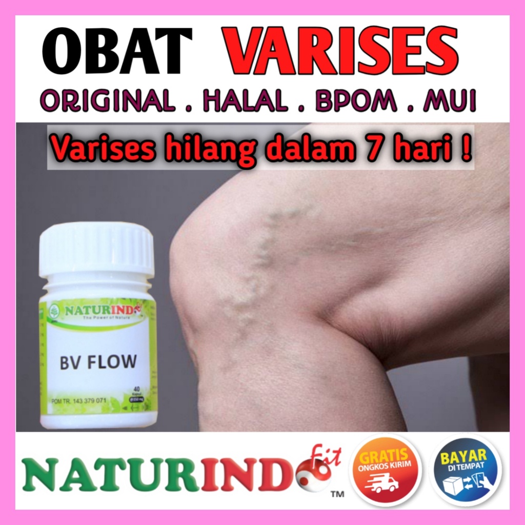 Jual OBAT VARISES KAKI TANPA SUNTIK MELANCARKAN PEREDARAN DARAH ...