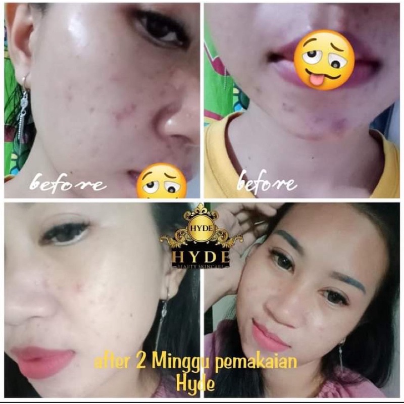 Jual JELLY GLOWING HYDE ( FREE POUCH ) | Shopee Indonesia