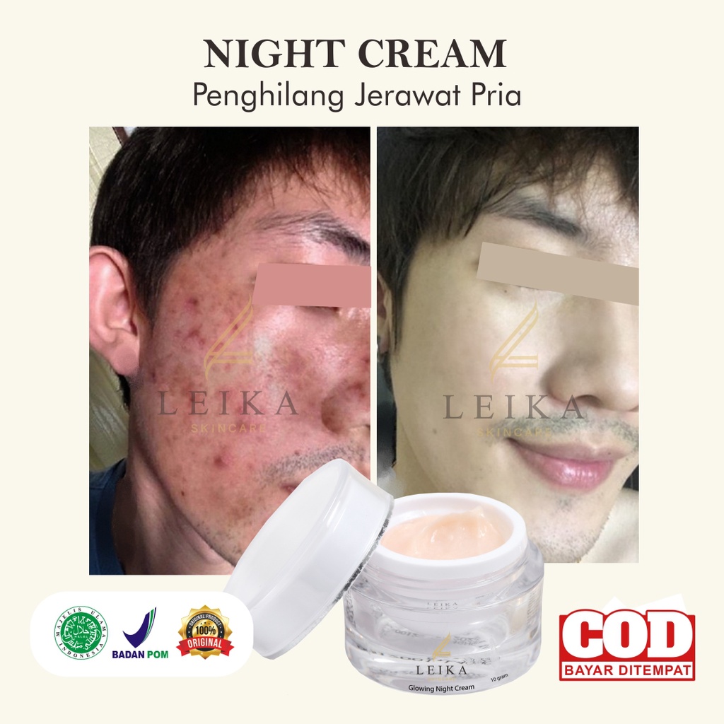 Jual Krim Jerawat Ampuh Menghilangkan Jerawat Night Cream Penghilang Jerawat dan Bekas Jerawat ...