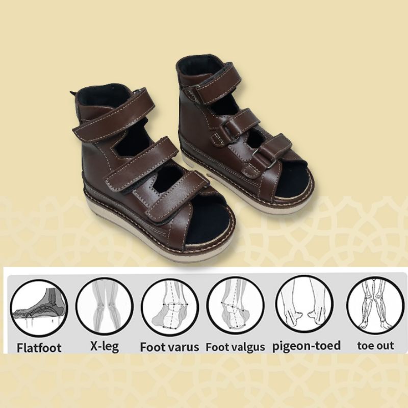 Jual #SEPATU ORTHOPAEDI #SEPATU CTEV #SEPATU KOREKSI #SEPATU KESEHATAN ...