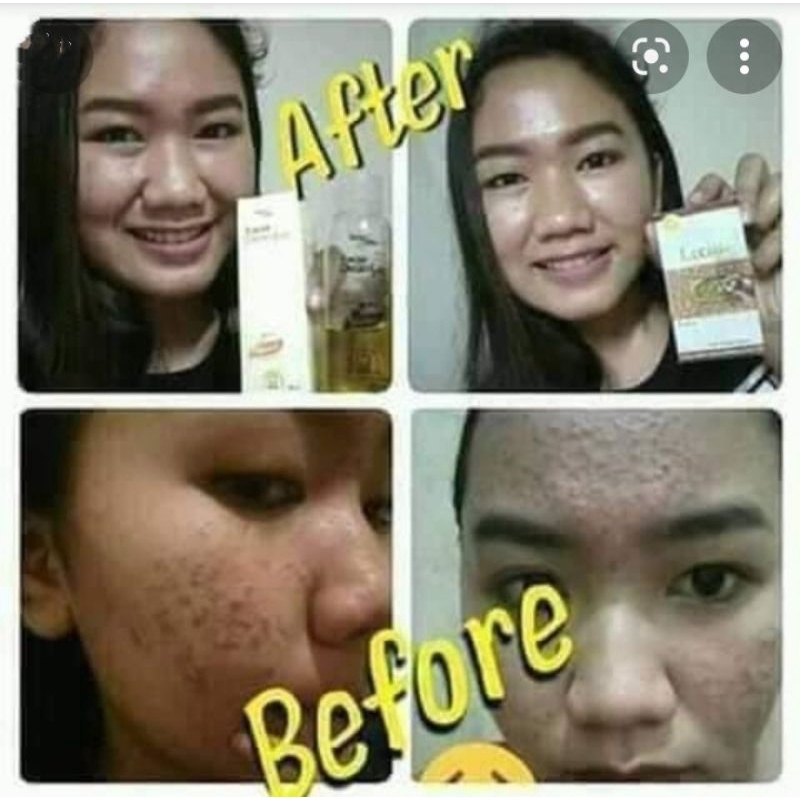 Jual COLLASKIN FACIAL CLEANSER (COFC) | Shopee Indonesia