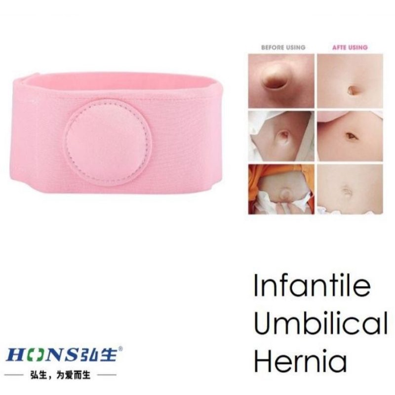 Jual Sabuk Hernia Bayi merk Hons Baby Umbilical Truss Belt Pusar Bodong ...