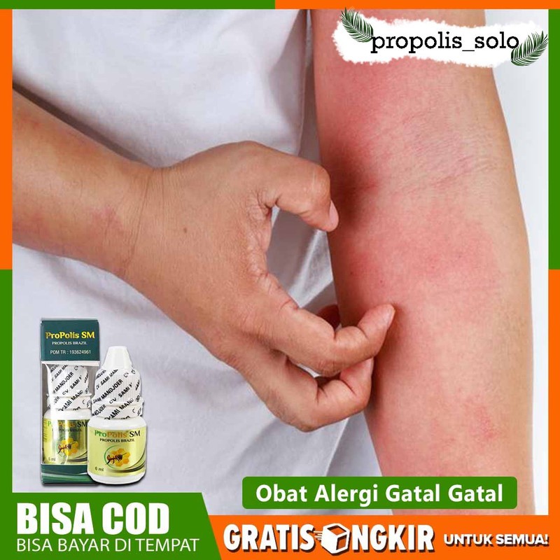 Jual Obat Alergi Gatal Ruam - Alergi Gatal Pada Kulit Anak - Obat ... Jual Obat Alergi Gatal Ruam - Alergi Gatal Pada Kulit Anak - Obat ...