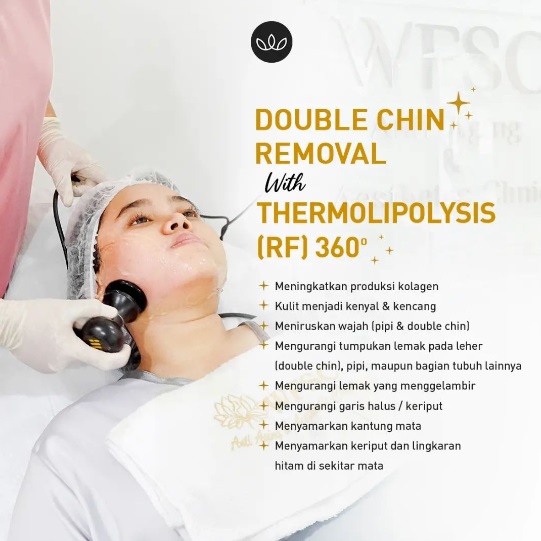 Jual Thermolipolysis (RF) 360 | Pipi Tirus | Double Chin | Perut ...