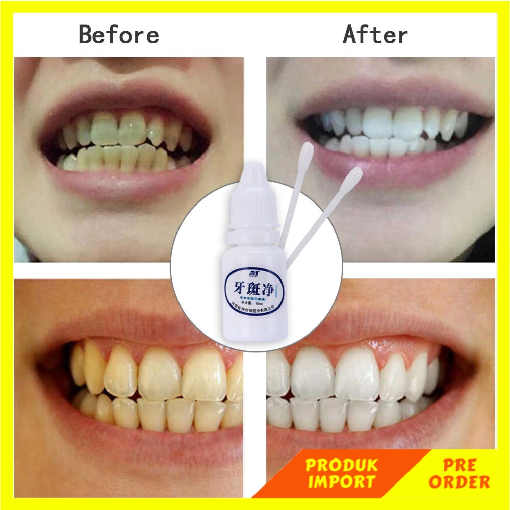 Jual PRODUK PO 10ml Teeth Whitening Essence Oral Hygiene Cleaning Teeth ...
