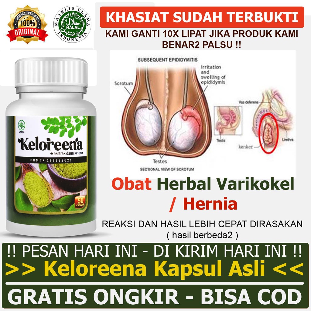 Jual Obat Varikokel Obat Buah Zakar Bengkak Testis Bengkak Sebelah Kiri