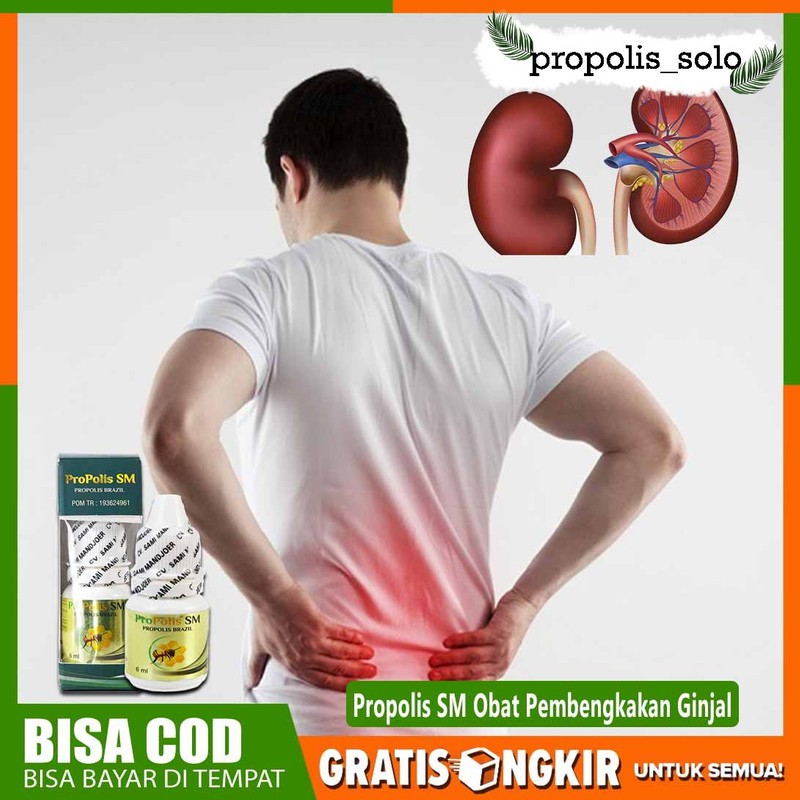 Jual Obat Ginjal Bengkak - Pembengkakan Ginjal - Herbal Propolis Sm ...